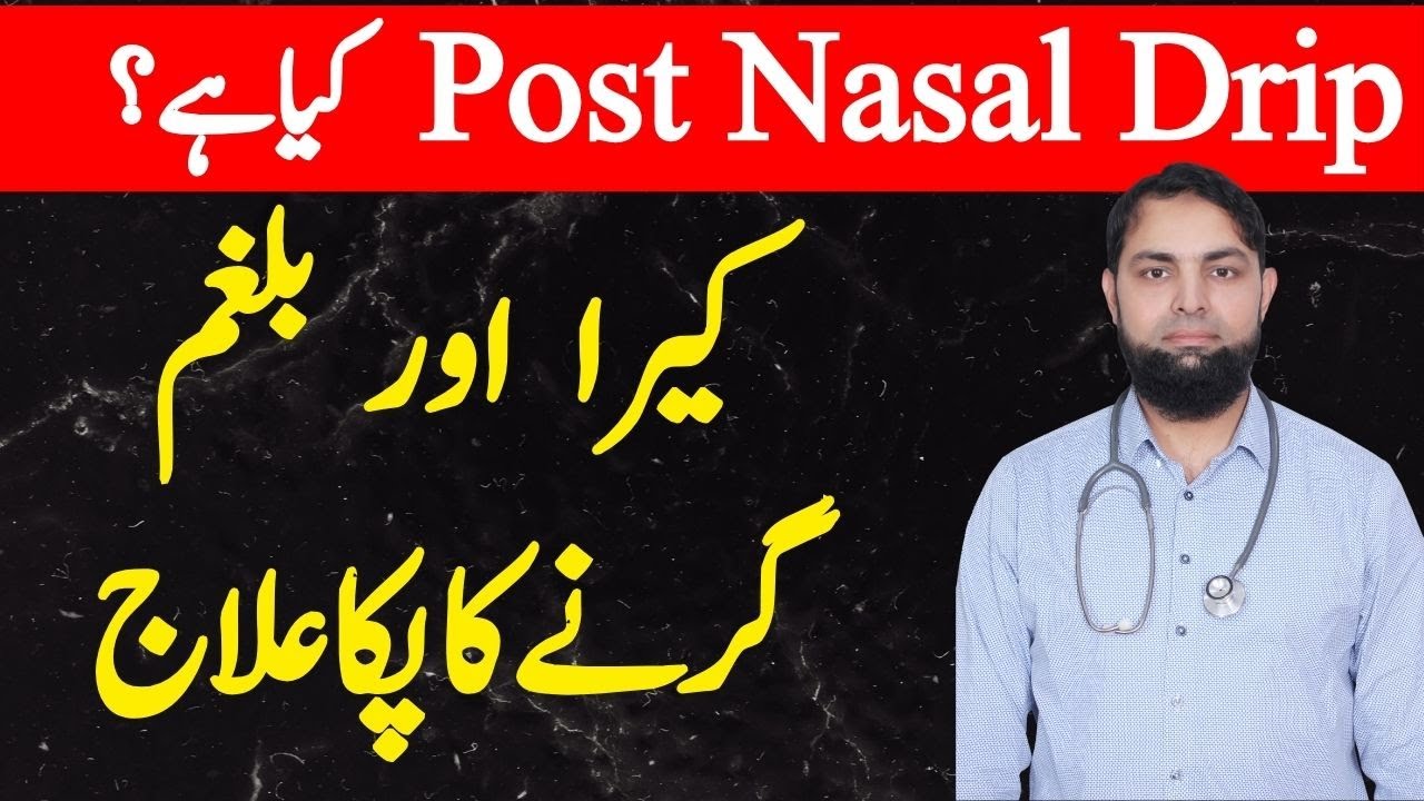 Post Nasal Drip and Sinus Congestion | Fast Relief Methods Explained ...