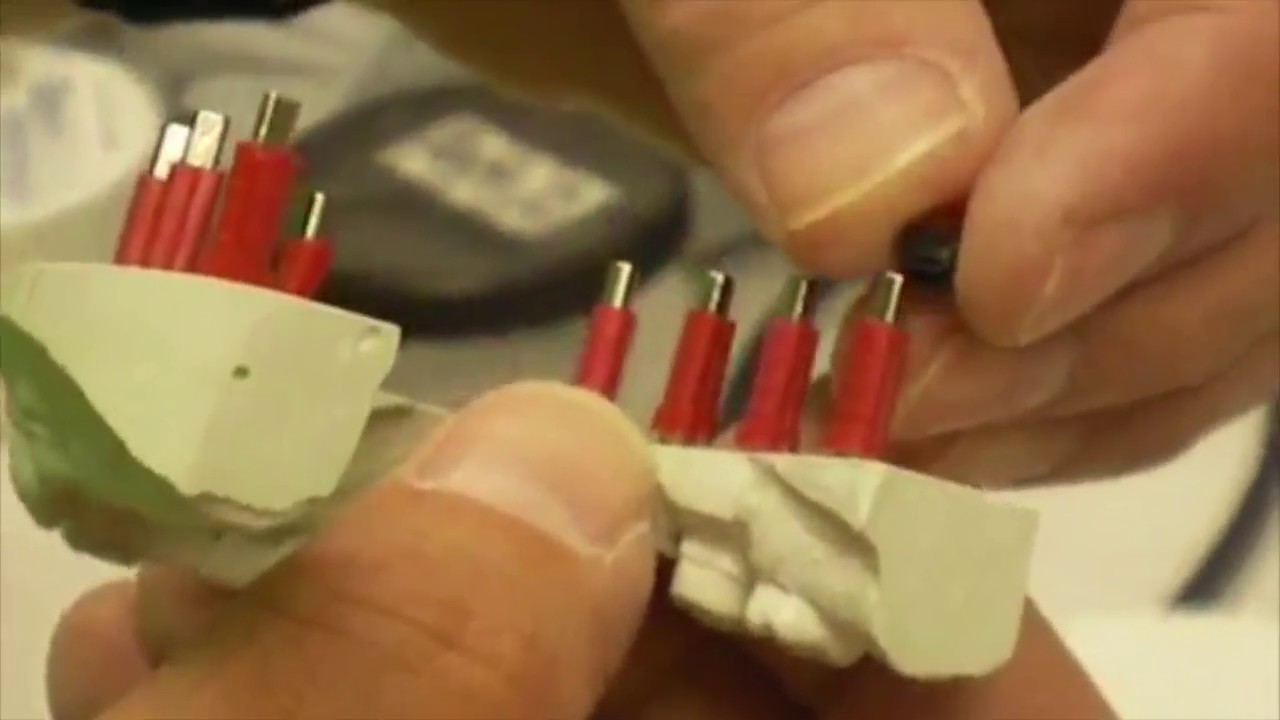 Preparation of the Working Cast: Placement of Die Pins & Base - YouTube