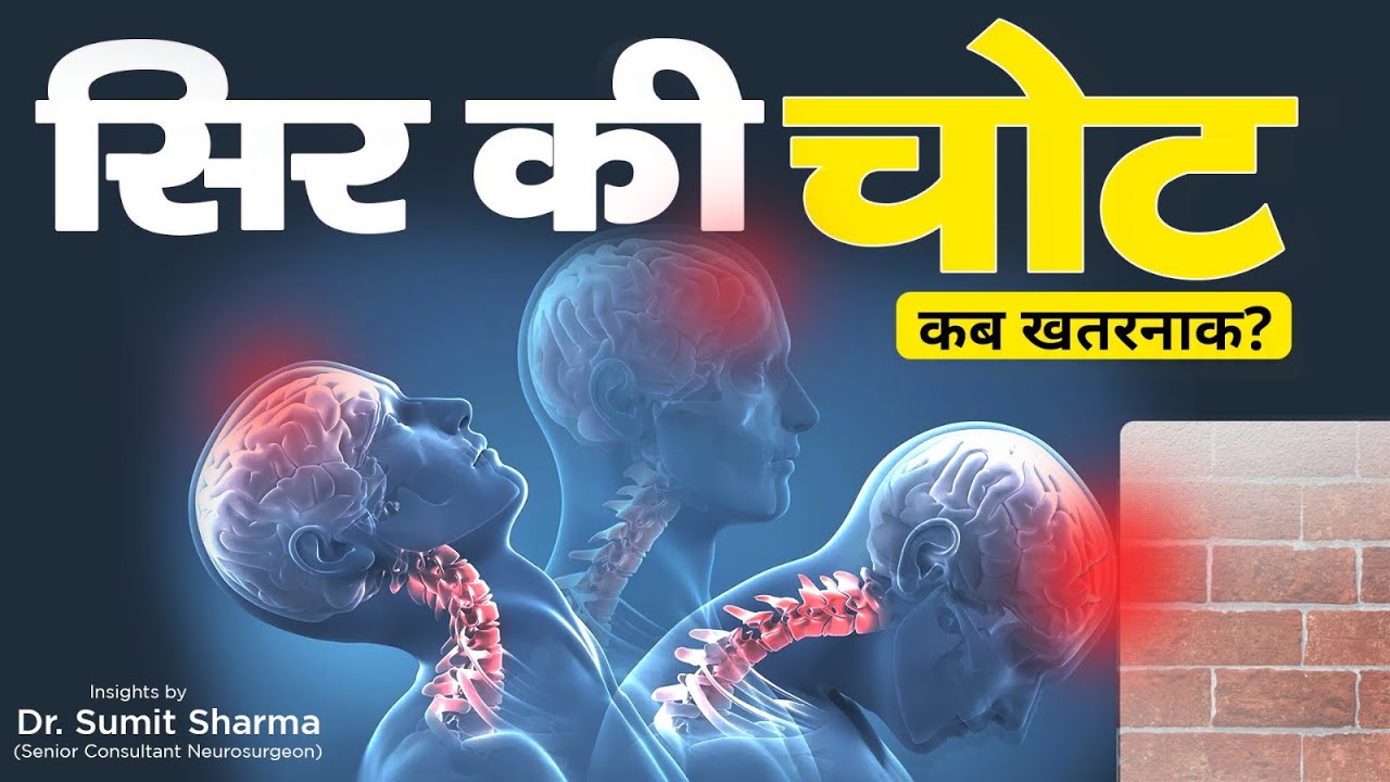 🧠 Head Injuries: Protect Your Brain, Protect Your Life! 🚑 - By Sumit ...