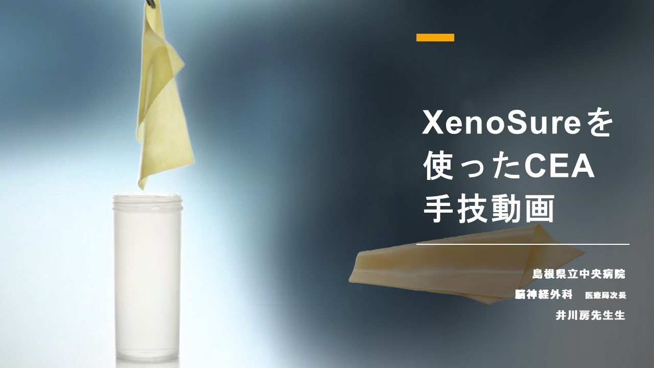 XenoSure CEA - YouTube