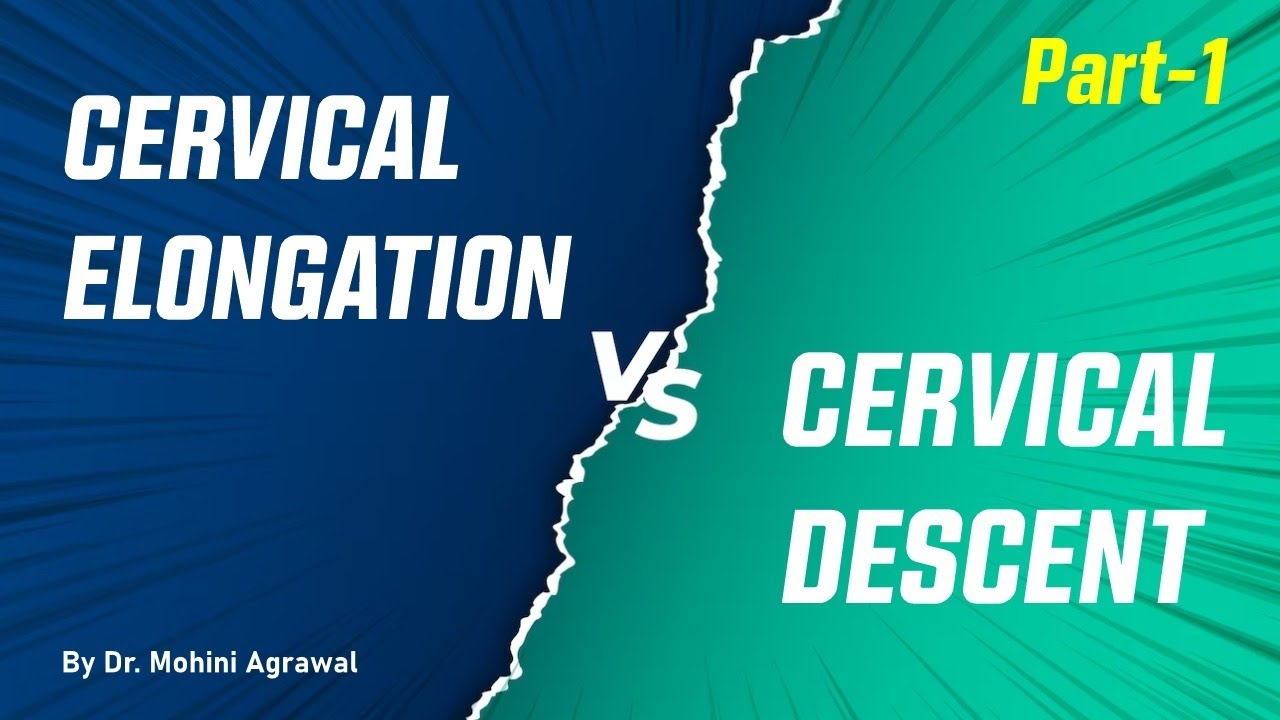 Cervical Elongation vs. Cervical Descent Explained by Urogynecology ...