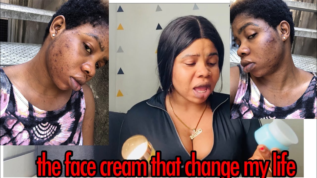 My New Face Cream Set | My Face Has Change - YouTube