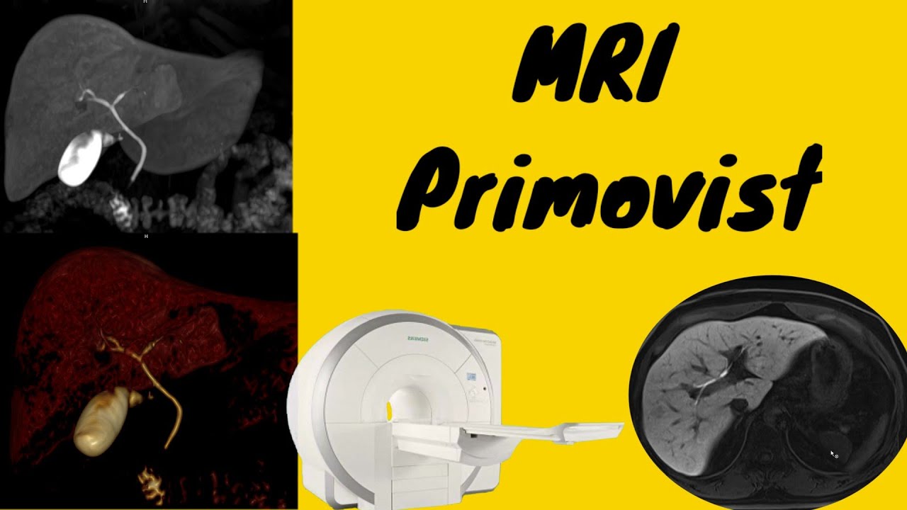 Cách chụp Mri gan với Primovist ( Liver Primovist) - YouTube
