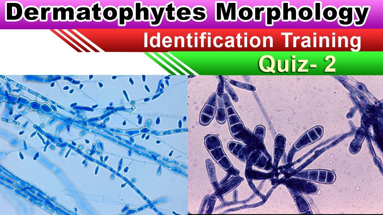 Dermatophytes Morphology Identification Quiz 2 - YouTube