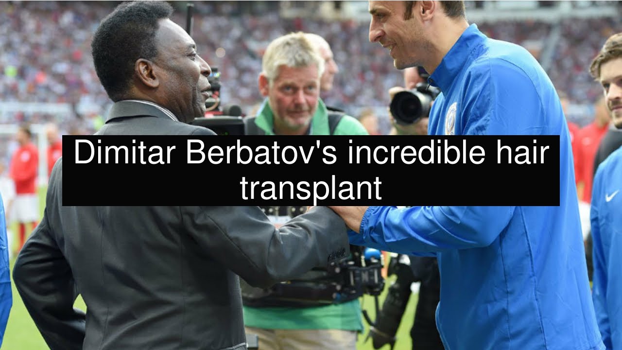 Dimitar Berbatov's incredible hair transplant - YouTube