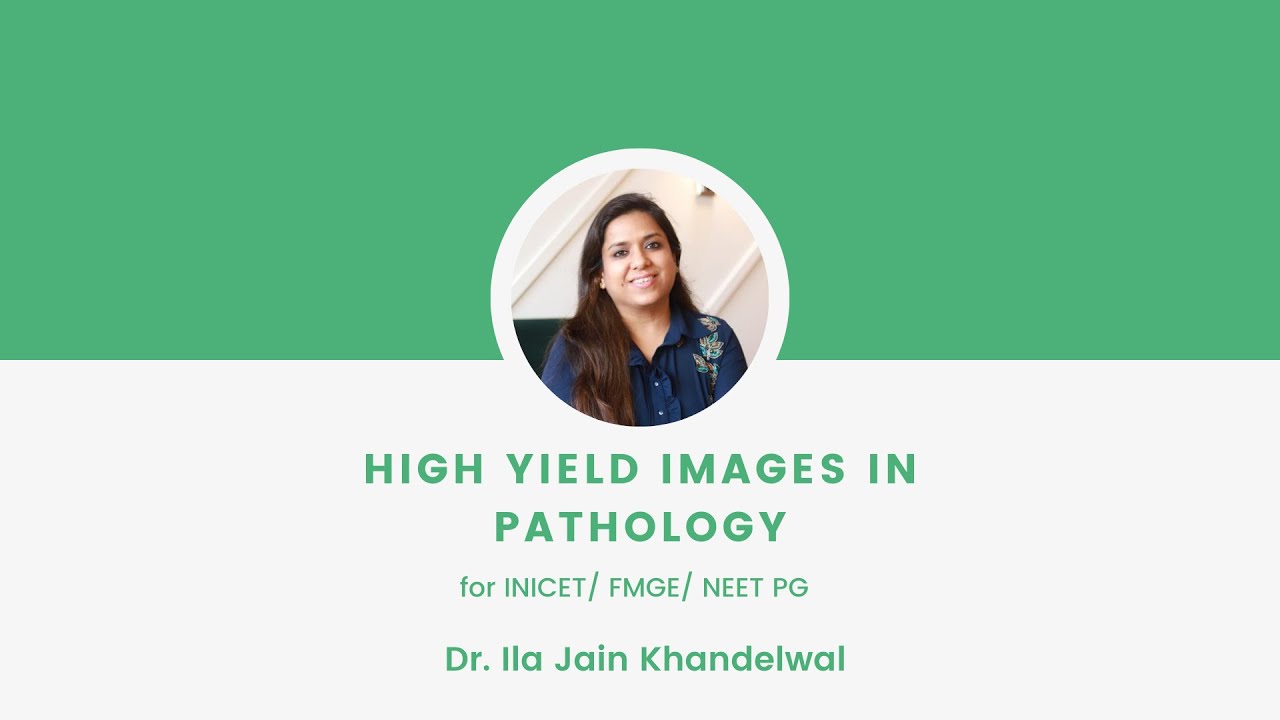 High yield images in Pathology for FMGE | Haematology | Dr. Ila Jain ...