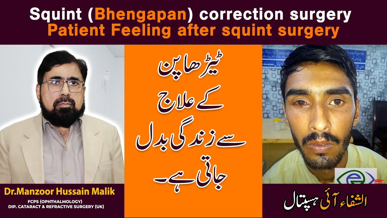 Squint/strabismus (Bhengapan) correction surgery | Patient Feeling ...