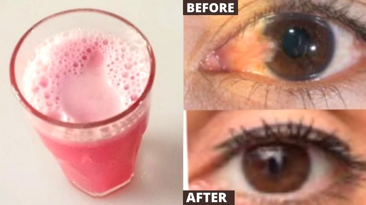 DRINK FOR STRONGER VISION AND REMOVE CATARACT I How to improve your ...