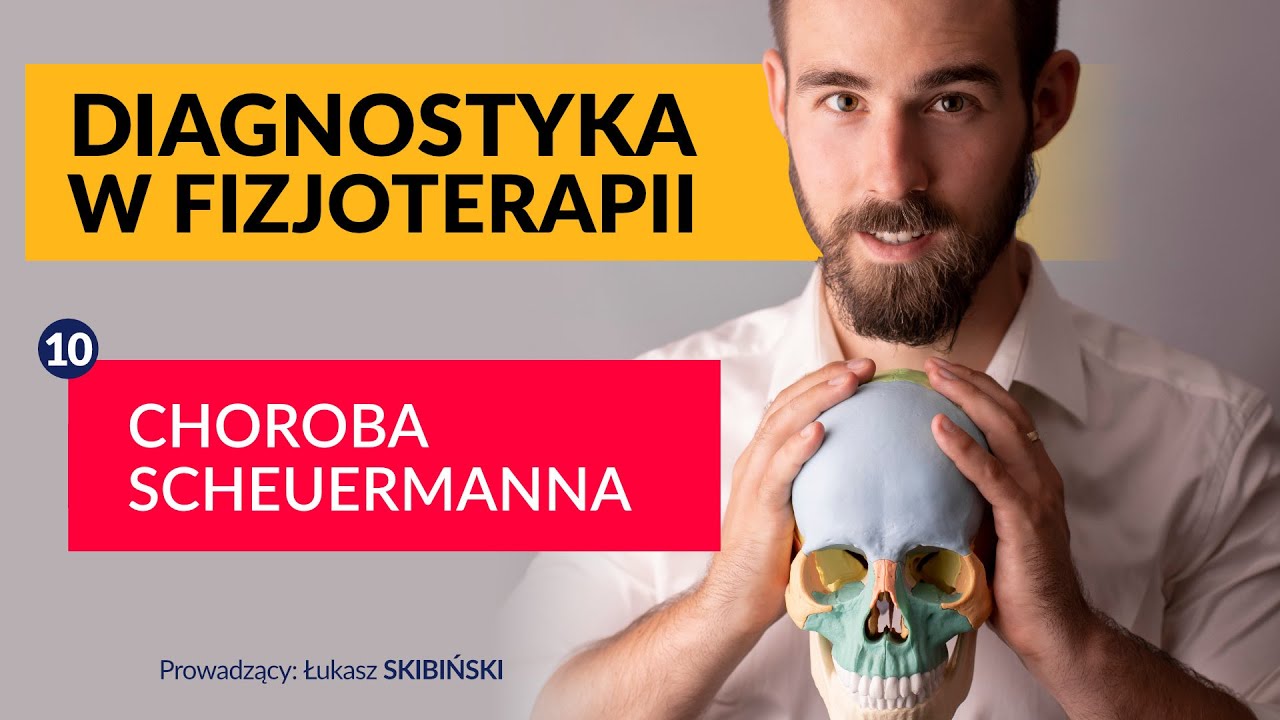 Choroba Scheuermanna. Diagnostyka w fizjoterapii. Odcinek 10 - YouTube