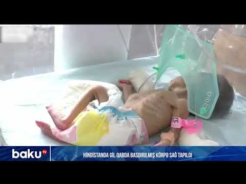 Hindistanda gil qabda basdırılmış körpə sağ tapıldı