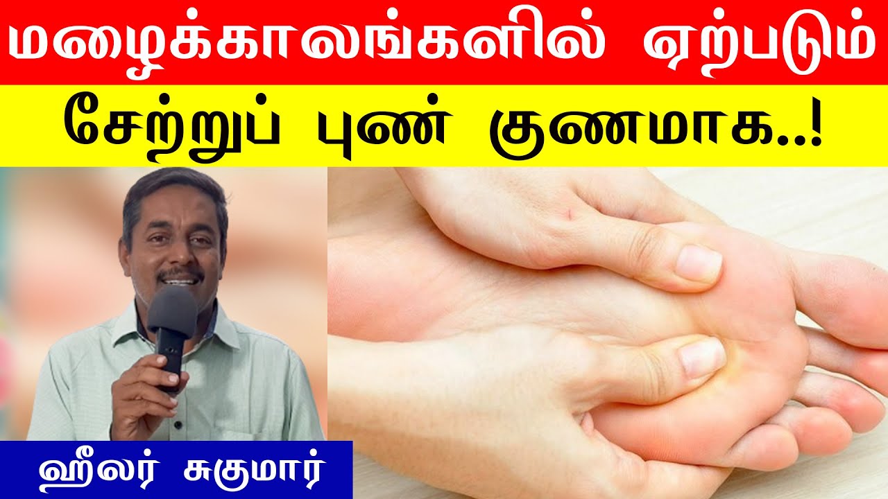 மழைக்காலங்களில் ஏற்படும் சேற்றுப் புண் குணமாக | setru pun home remedies ...