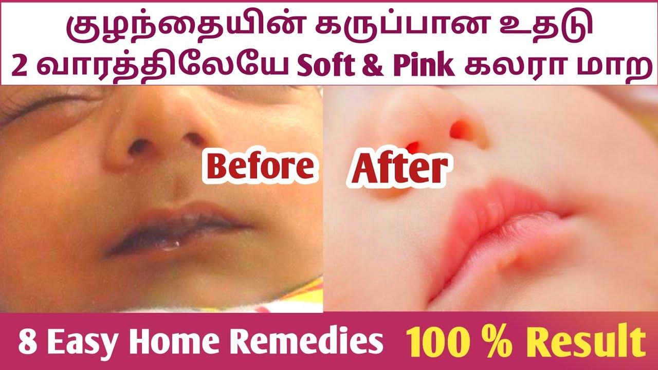 Improve baby lips color naturally / Baby lips black after feeding ...