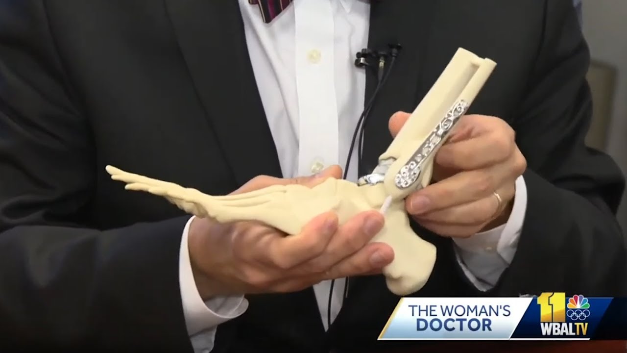 Innovative Ankle Replacement Surgery - Dr. Lew Schon - Mercy - YouTube