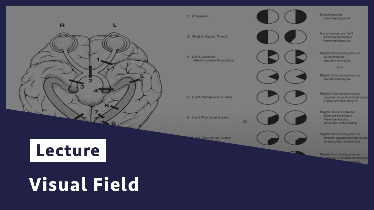 Visual Field - YouTube