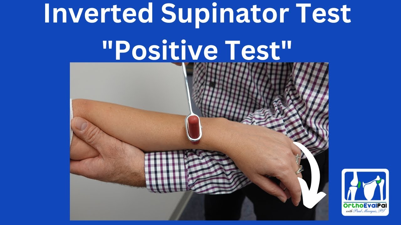 Inverted Supinator Test (Positive Test) - YouTube