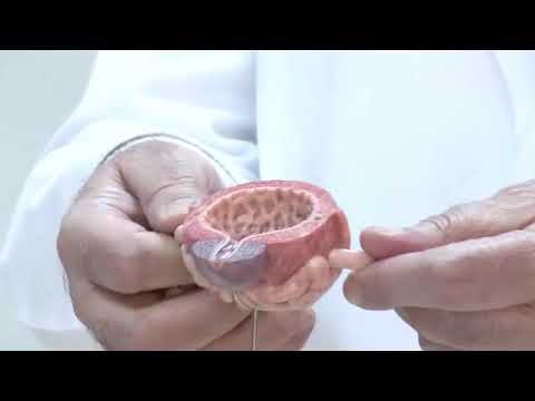 ATA-AÖF Tıbbi Terminoloji Ünite 9
