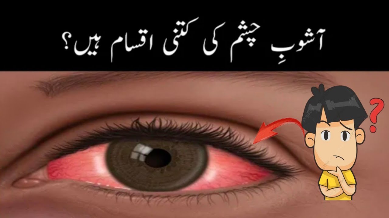 Conjunctivitis | Pink Eye | Meaning |Types | Causes | Symptoms | Treatment of Conjunctivitis ...