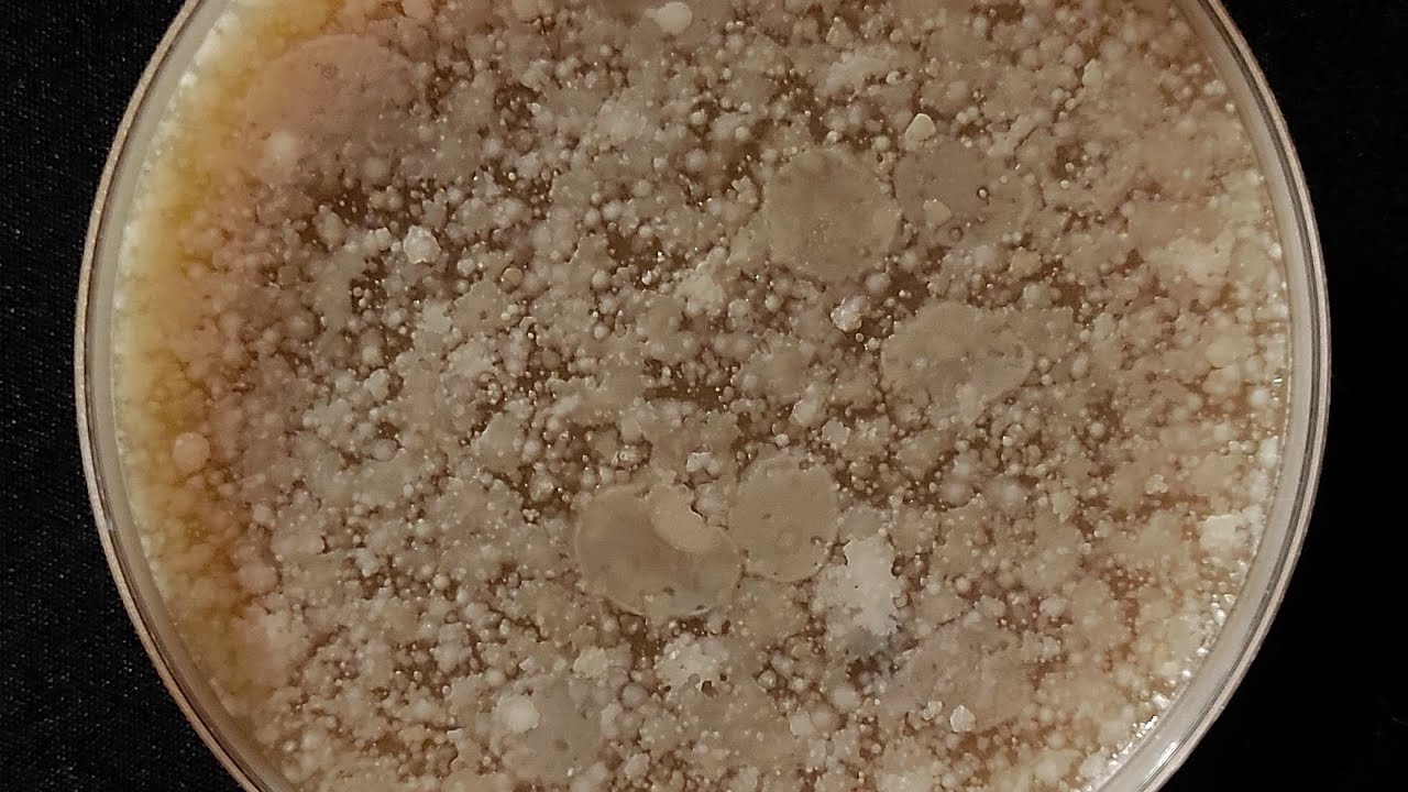 Isolation of Rhizobium from Root nodules - YouTube