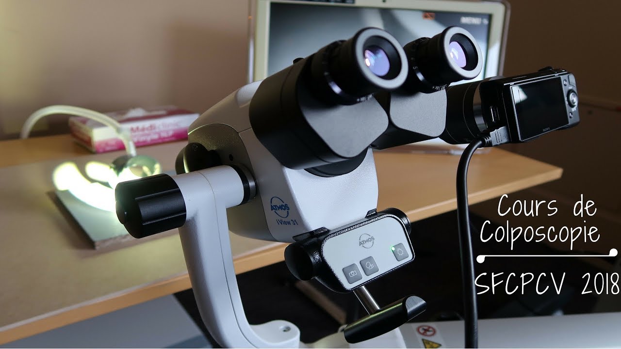 COURS DE COLPOSCOPIE - SFCPCV 2018 - YouTube