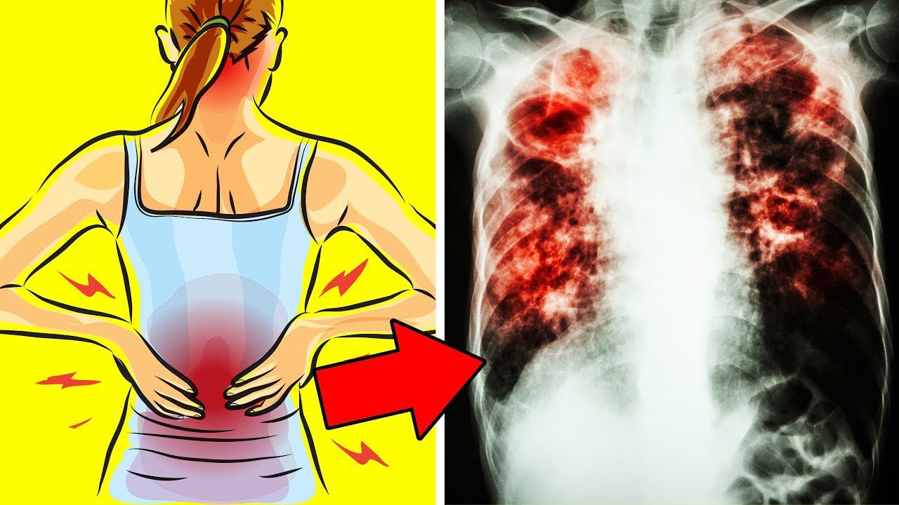 I 8 Segnali Di Avvertimento Che i Polmoni Sono In Cerca Di Aiuto - YouTube