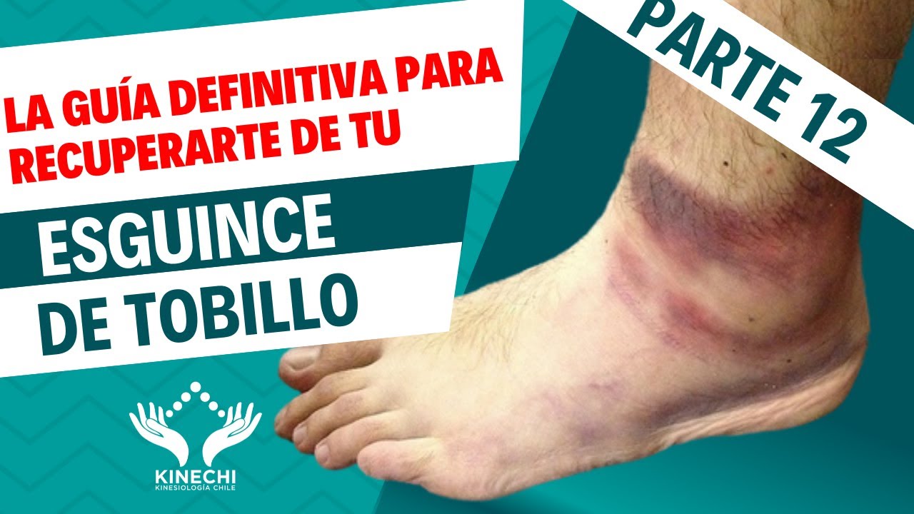 Fortalece tus pantorrilas y tobillos tras un esguince: eversión de ...