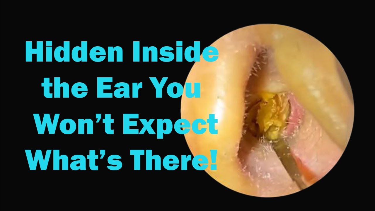 Hidden Inside the Ear - You Won’t Expect What’s There - YouTube