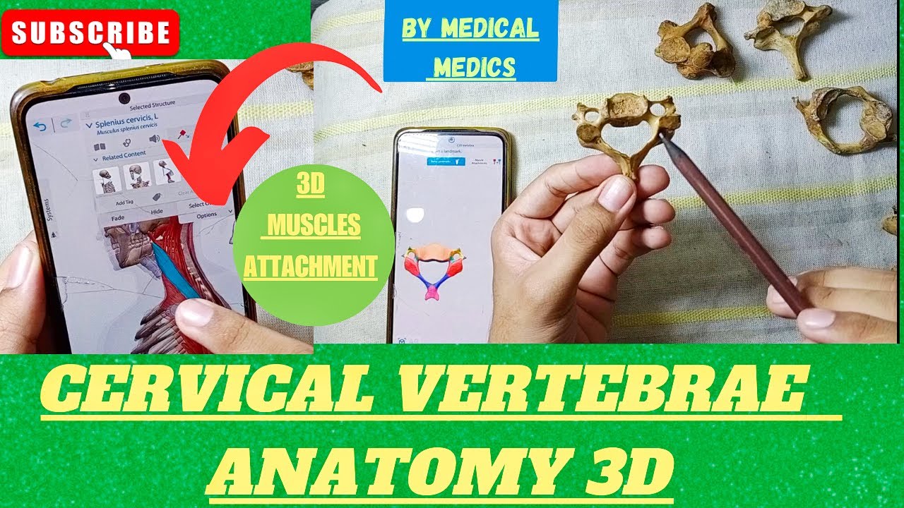 Cervical Vertebrae Anatomy 3d | Typical Cervical Vertebrae | Bony ...