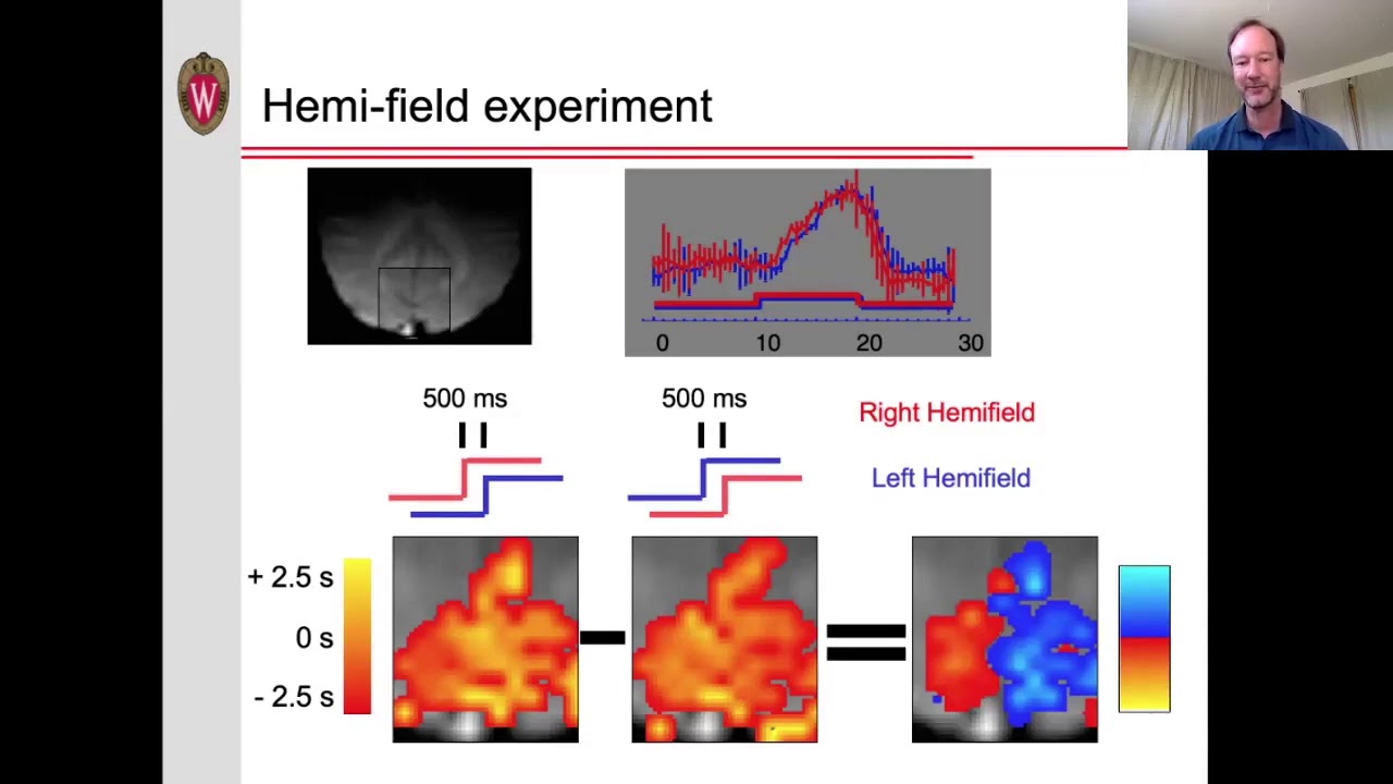 Functional MRI (fMRI) - 3: Temporal dynamics - YouTube