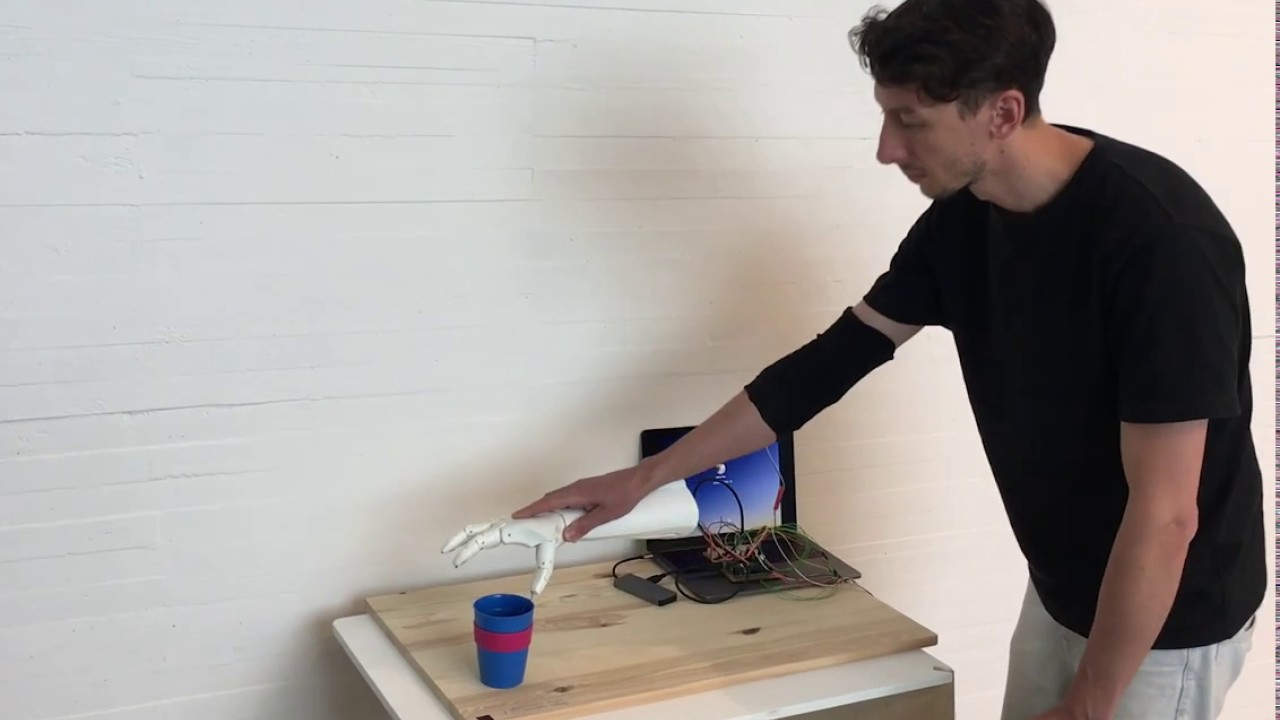 GRASP Prosthetic Arm - YouTube