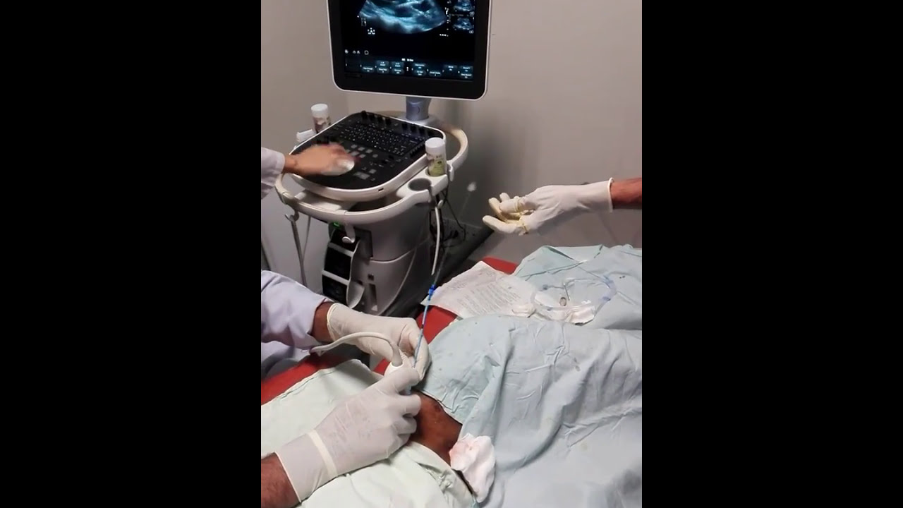 Emergency Percutaneous Nephrostomy solely under Ultrasound guidance ...