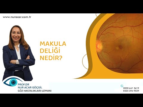 Makula Deliği Nedir? | Prof. Dr. Nur Acar Göçgil