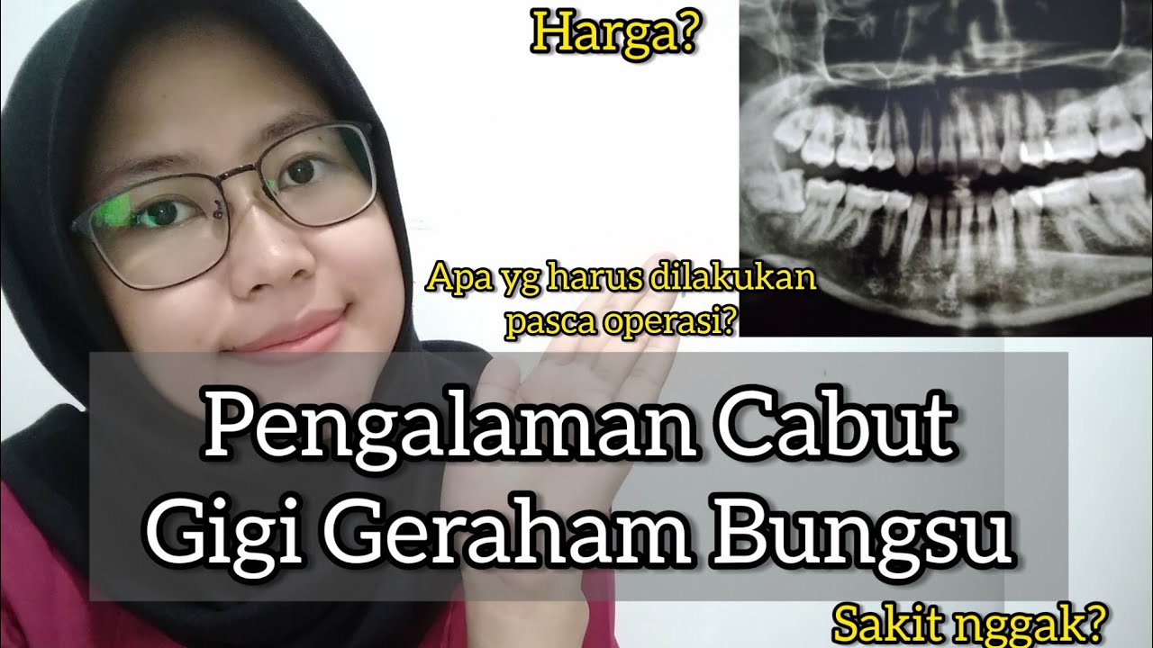 Pengalaman Cabut Gigi Bungsu - YouTube