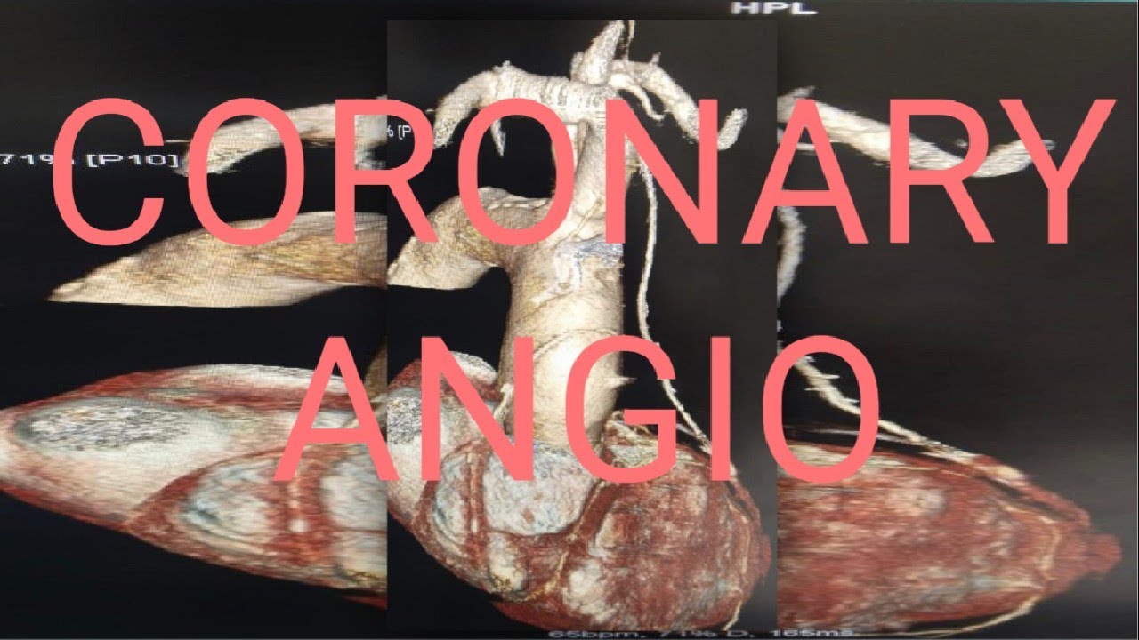 CARDIAC CT/CORONARY ANGIO RADIOGRAPHER PART 1 - YouTube