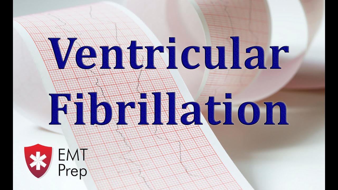 Ventricular Fibrillation ECG - EMTprep.com - YouTube