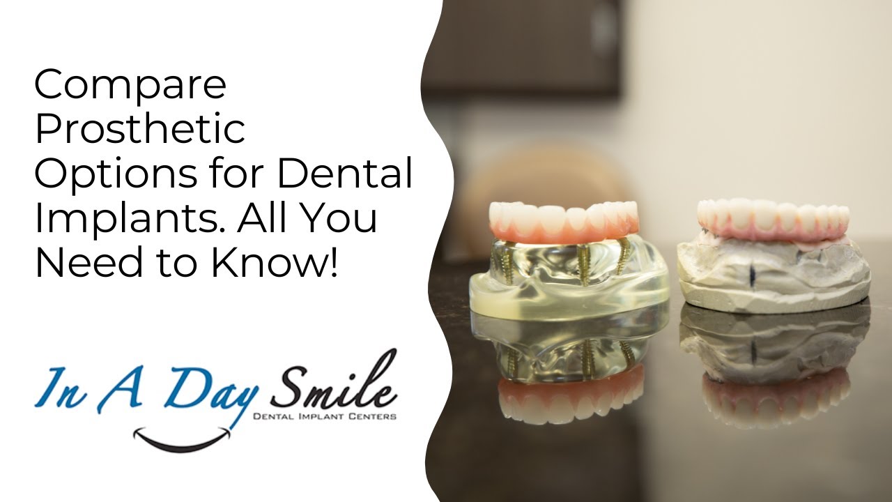 Compare Prosthetic Options for Dental Implants. All You Need to Know ...