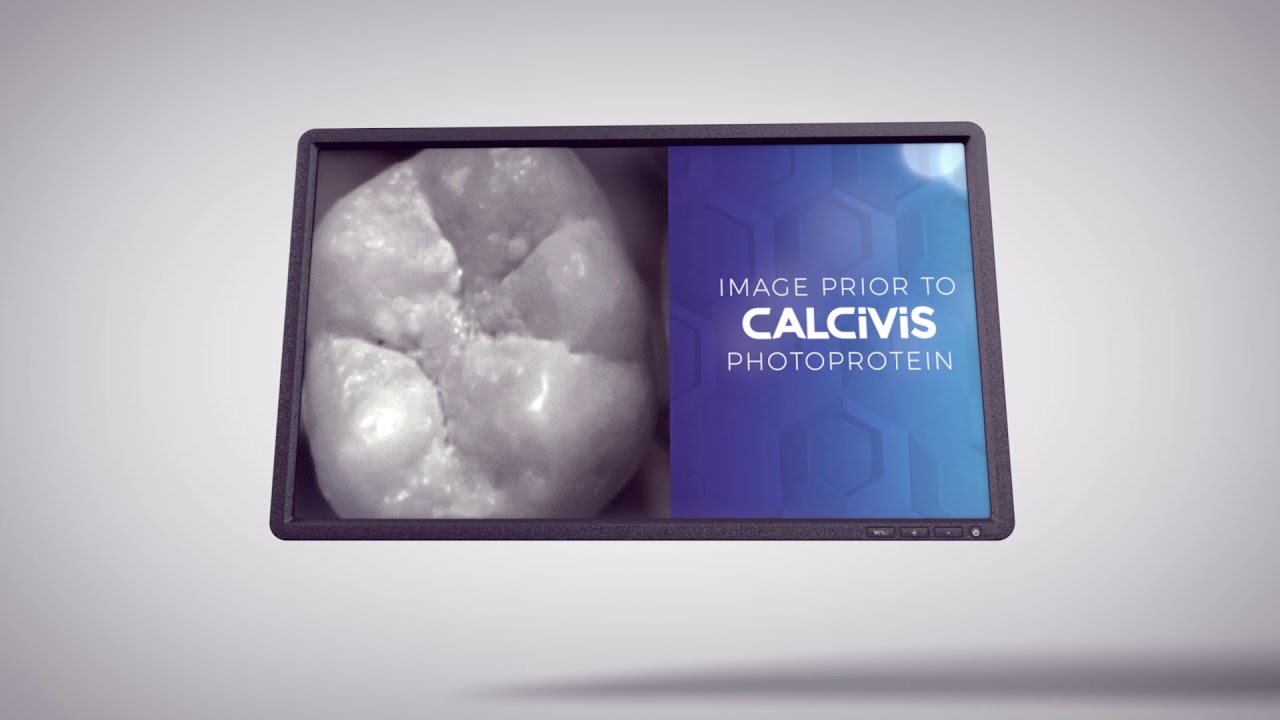 Calcivis imaging system - YouTube