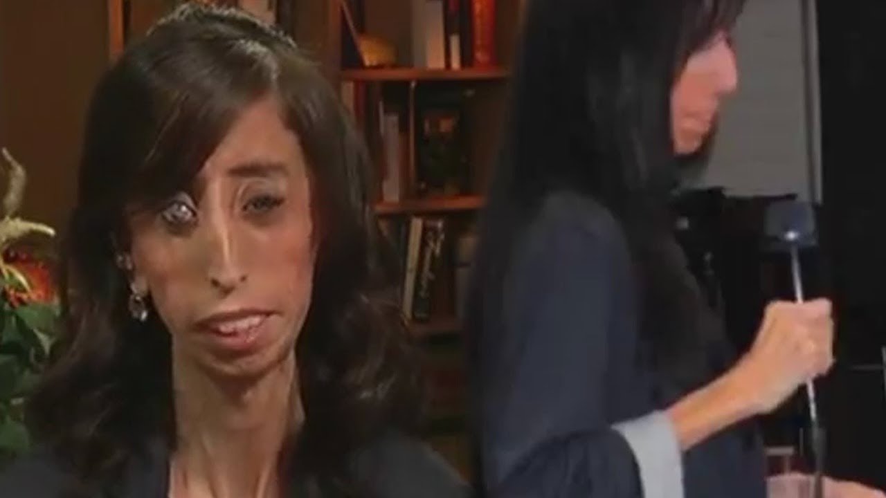 'La Mujer Mas Fea Del Mundo' En Realidad Es Hermosa - YouTube