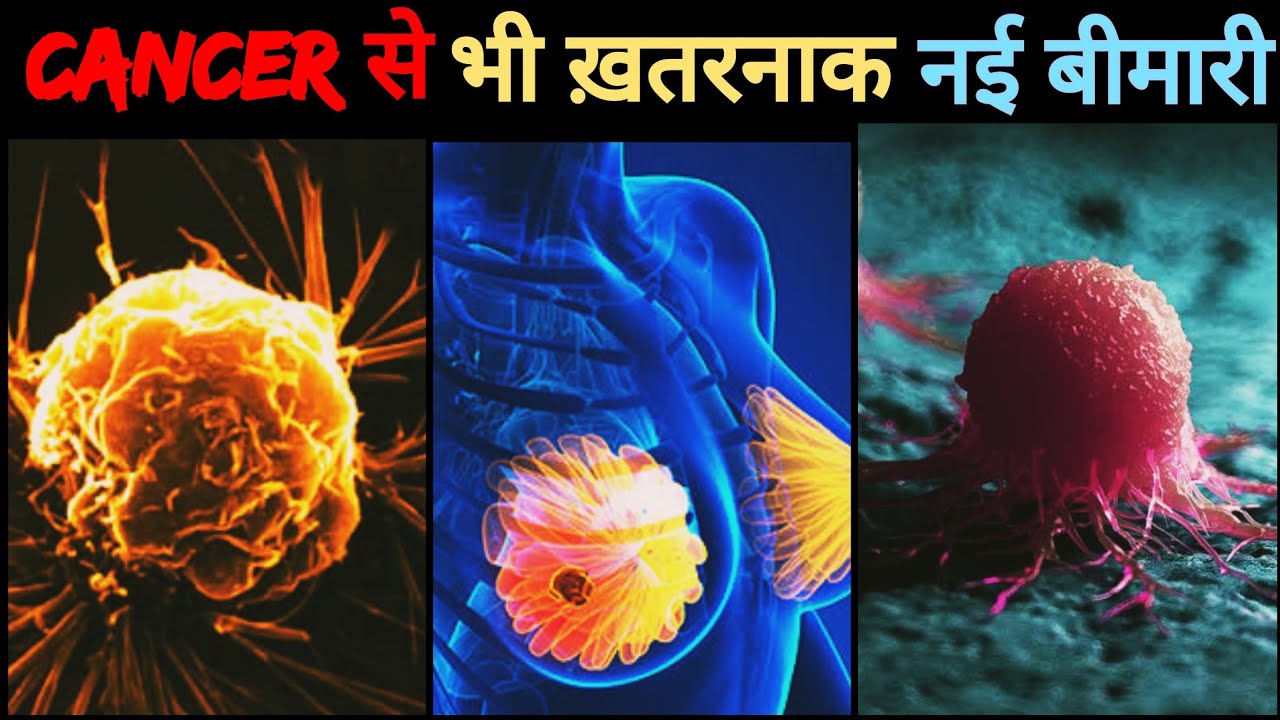 Cancer से ख़तरनाक नई बिमारी - YouTube