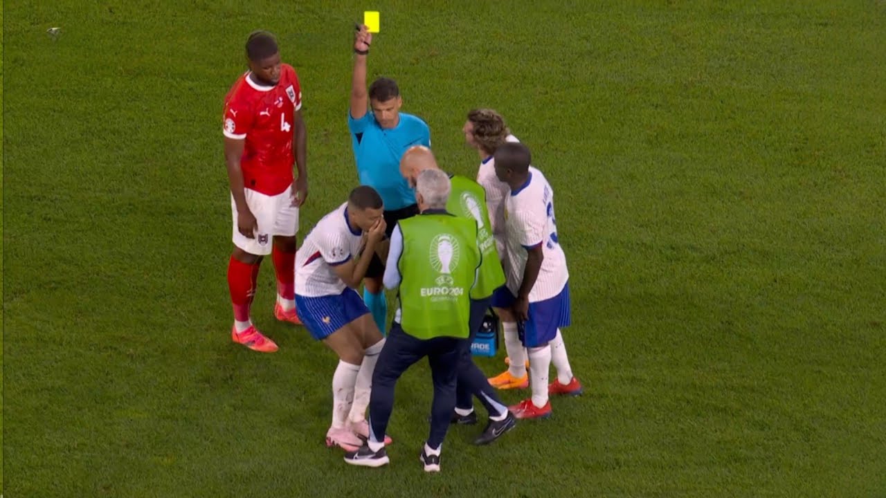 Mbappe got yellow card after broken nose & suddenly came on ground ...