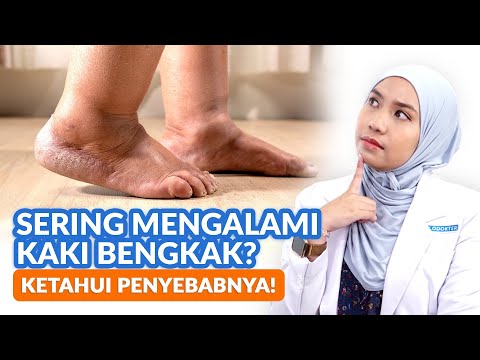 Kaki Bengkak Tanpa Cedera? Ini Penyebab dan Cara Mengatasinya!