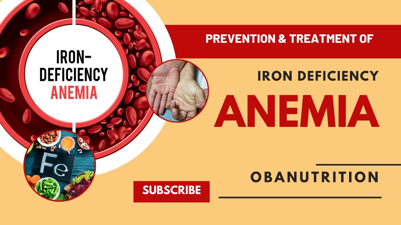 ObaNutrition: HOW DO YOU PREVENT AND TREAT IRON DEFICIENCY ANEMIA (LOW ...