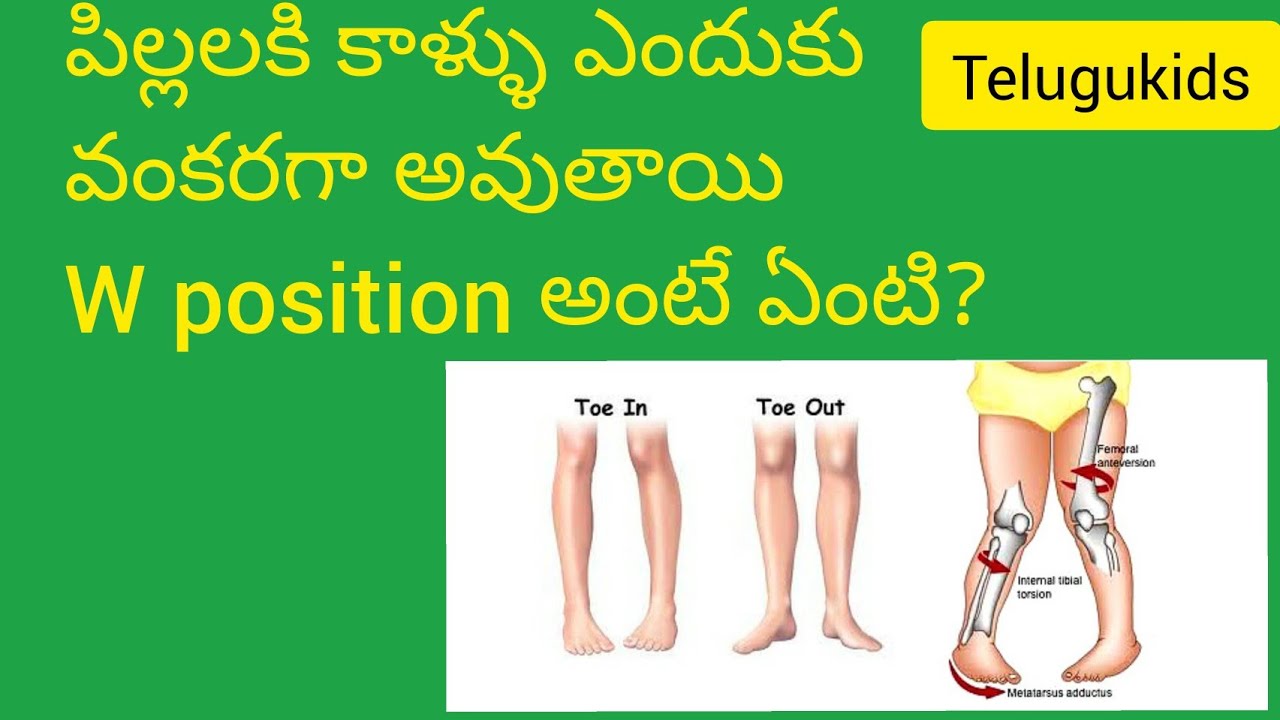 Is W position bad for kids, W Position లో పిల్లలు కూర్చుంటే ఏమి ...