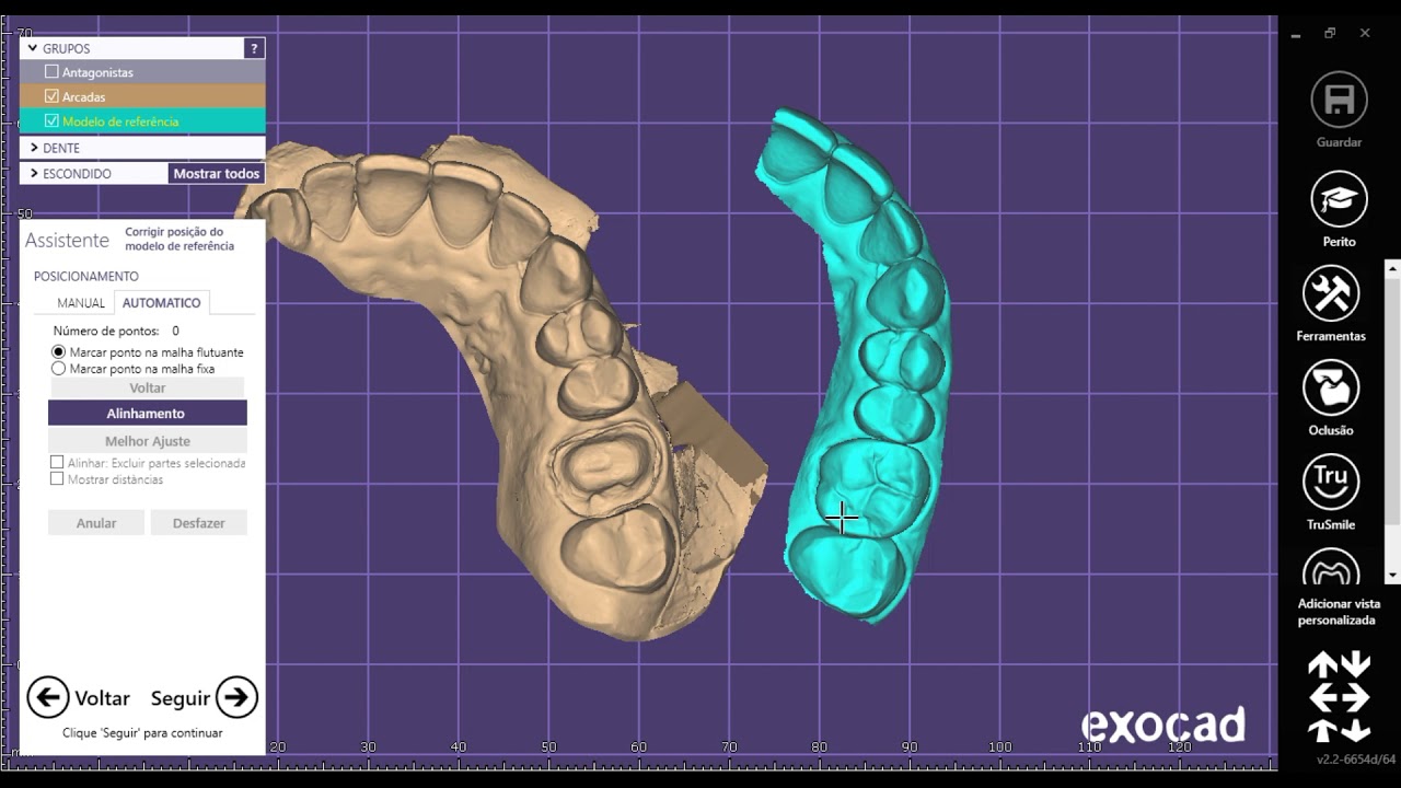Importação, Alinhamento e Recortes de STL ( ExoCad ) - YouTube