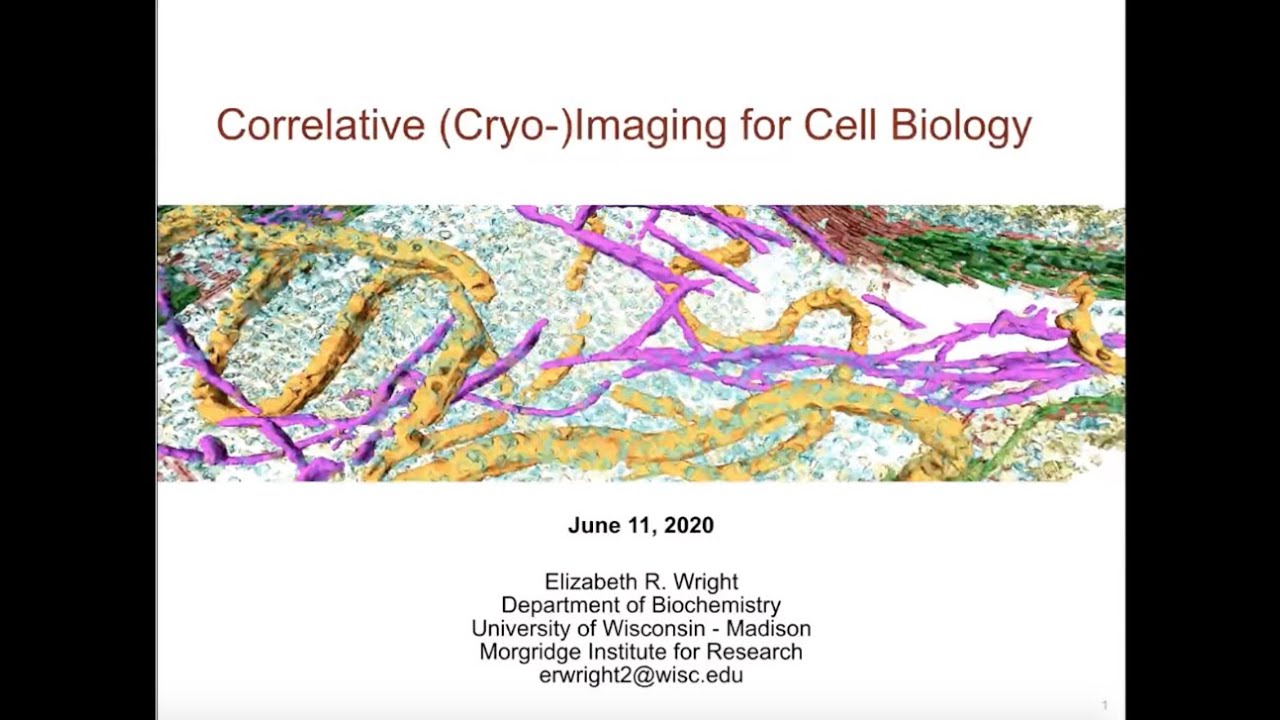 Cryo-CLEM webinar series: No1 - Correlative (cryo-)microscopy for cell ...