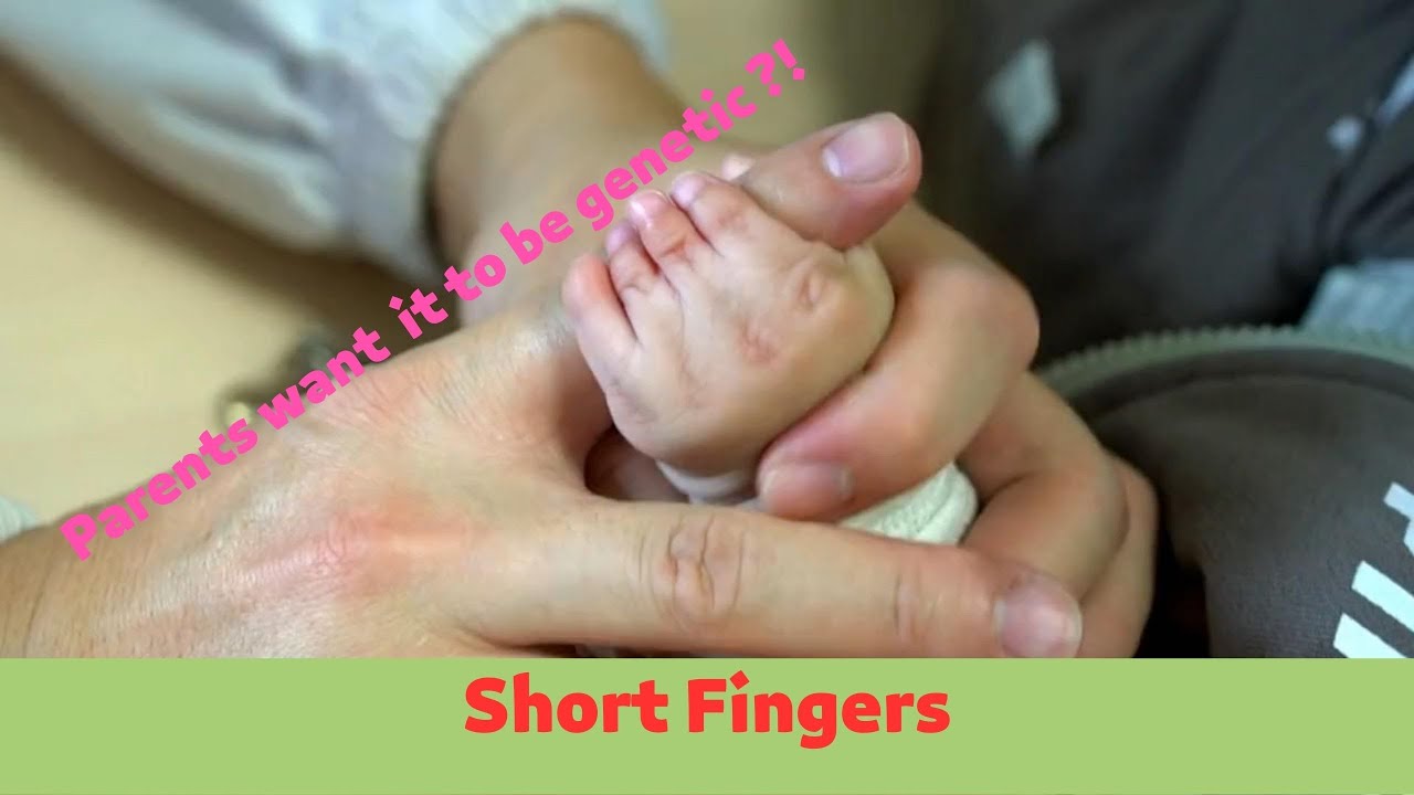 Brachydactyly | Baby Had Short Fingers, Mother Wanted it to Be Genetic ...