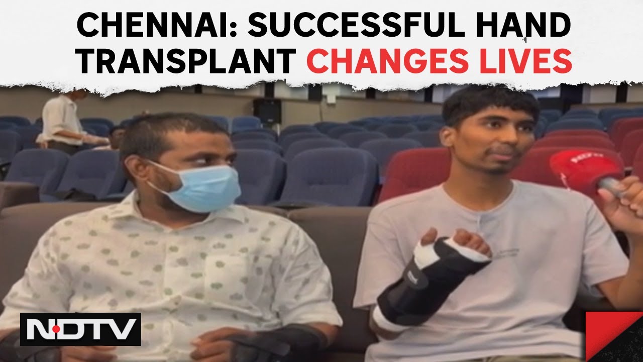 Chennai Hand Transplant | Man After Successful Hand Transplant ...