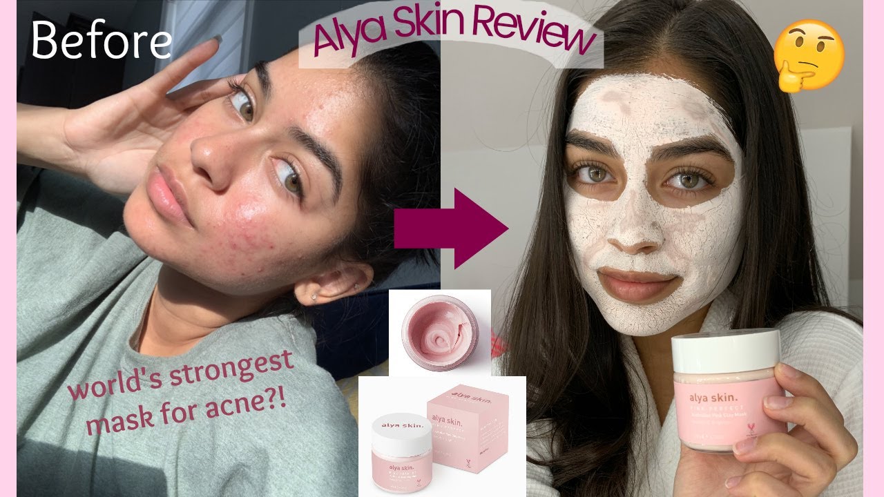 Alya Skin Australian Pink Clay Mask Review Most Powerful Acne Mask Youtube