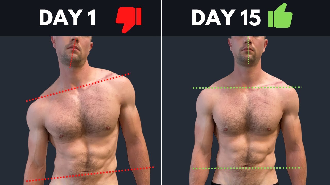 How To Un-Fu*k Your Posture - This New Methodology Fixes You From Head To Toe - YouTube