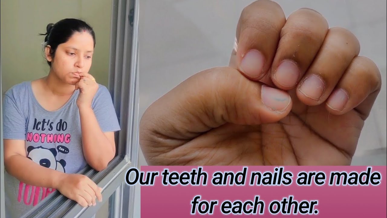 The psychology behind nail biting ||Nail Biters || #arpitaawoman - YouTube