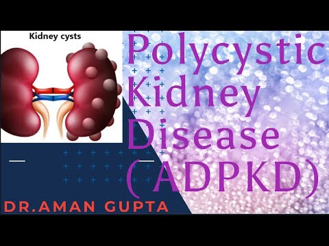 ADPKD( Polycystic Kidney Disease ) हिन्दी में । Dr. Aman Gupta - YouTube